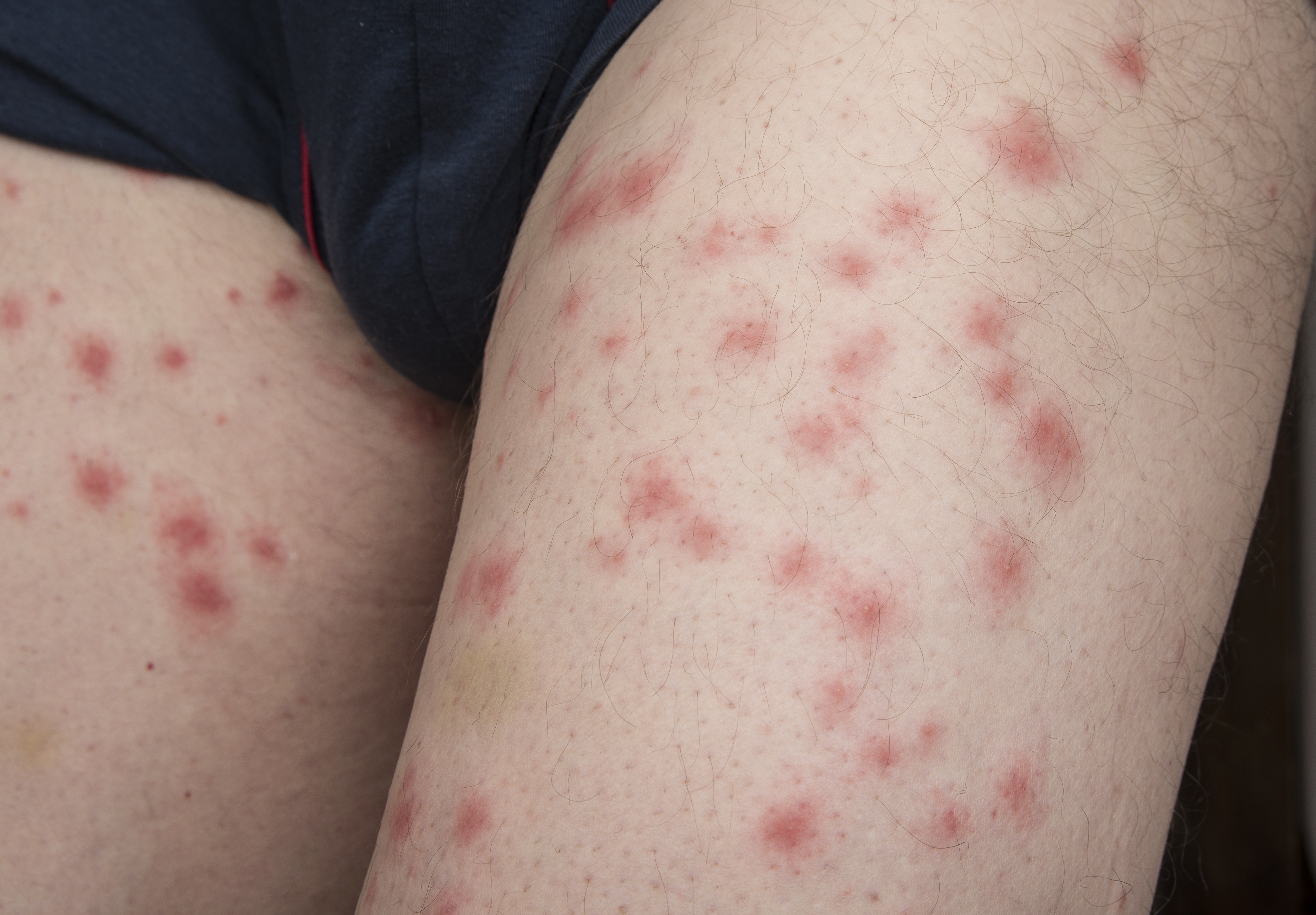 Bed Bug Control in Delaware | Bennett Termite & Pest Solutions